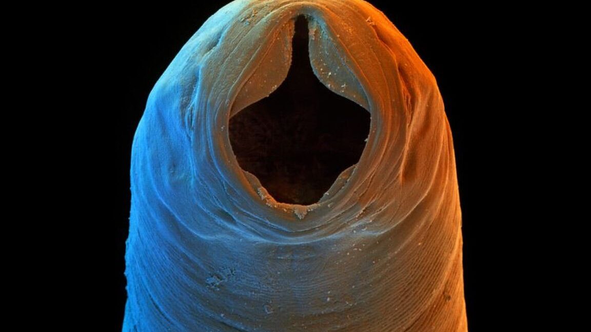 17 Principales diferencias entre lombriz intestinal y lombriz solitaria ...